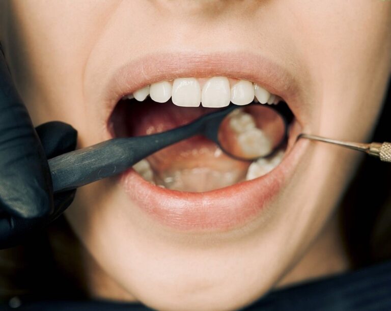 Smile Design | Winning Smile Dental Clinic, Makati City, Metro Manila ...